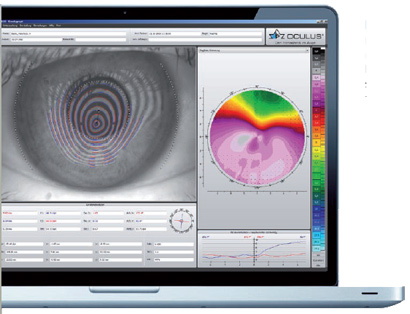 Sichtwerk – Brillen & Kontaktlinsen – Optiker in Nürnberg